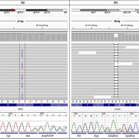Igv Snapshot And Sanger Sequencing Confirmation Of Variants A Download Scientific Diagram