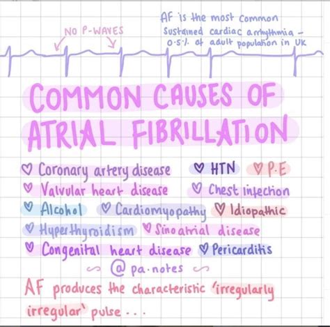 Atrial Flutter Artofit