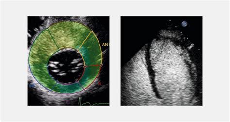 Cardialysis Echocardiography