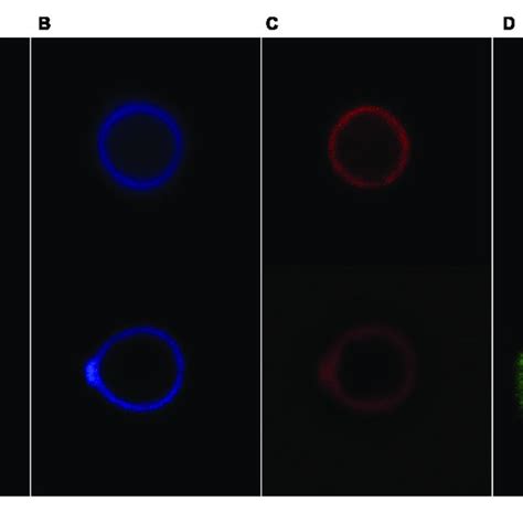 Scytovirin Localization To The C Neoformans Cell Wall Cryptococcus Download Scientific