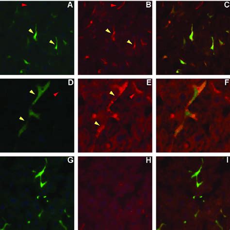 Kupffer Cells And Viral Transduction After Portal Vein Injection Of