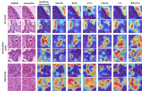 Gradient Weighted Class Activation Map For Each Model When Resnet34 Is Download Scientific
