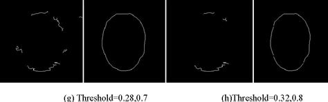 Figure From Ultrasound Images Edge Detection Using Anisotropic Diffusion In Canny Edge