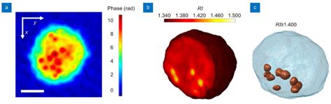 Hot Paper In Flow Holographic Tomography Boosts Lipid