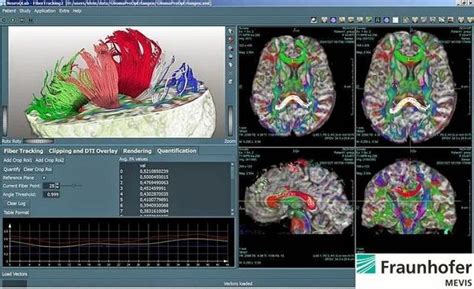 How To D Print Your Mri Data Dprint The Voice Of D Printing Additive Manufacturing