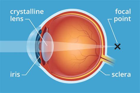 Presbyopia Women Fitness