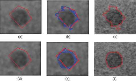 Comparison Between Corsis Method And The New Hybrid Gvf Gac Model A Download Scientific