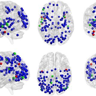 Processing Pipeline For Brain Structural And Functional Network Download Scientific Diagram