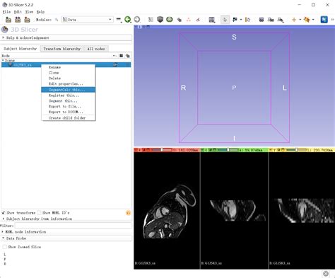 Github Shine Cmr Slicer