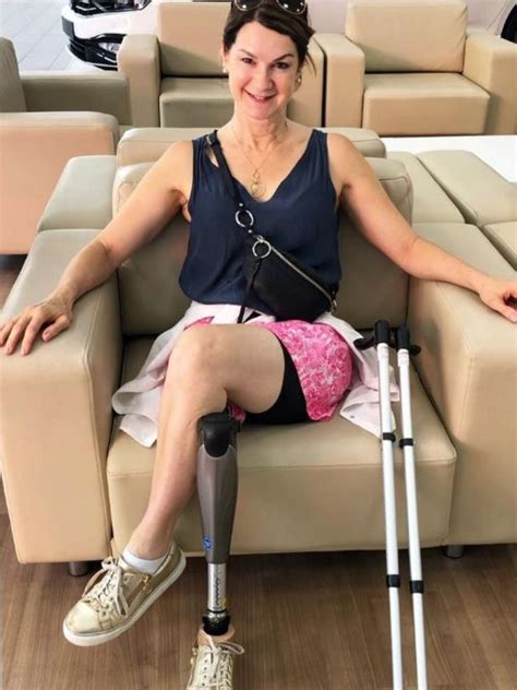 Sydney Womans Rare Cancer Leads To Full Leg Amputation Daily Telegraph