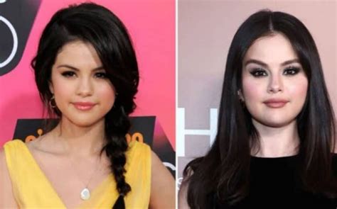 Selena Gomez S Before And After Looks Calm Down Singer S Beauty Transformation Over The Years