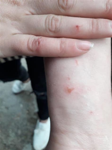 “policia Dhunon Fëmijët Te Bregu I Lumit Edi Rama Do Mbash Përgjegjësi” Klevis Balliu