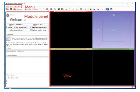 The Interface Of 3d Slicer Software Version 4102 Download