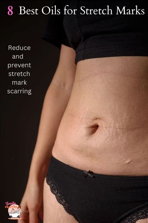 8 Best Oils For Stretch Marks Top Picks For Smoother Skin Beauty Crafter