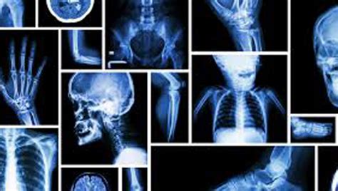 Radiographer X Rays