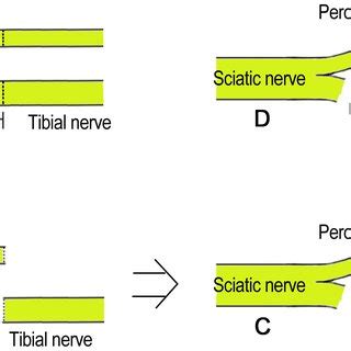 Surgical Procedures A The Right Sciatic Nerve And Its Two Main