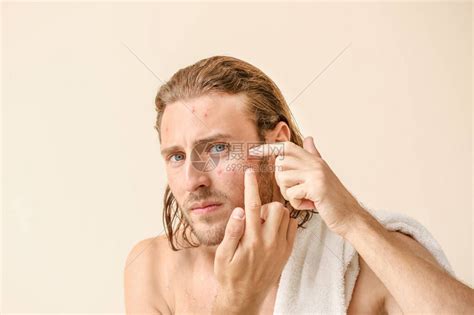 青春男子的血管问题肖像缠着彩高清图片下载 正版图片506243513 摄图网