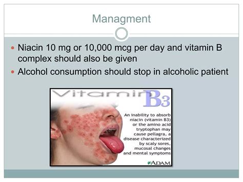 Vitamins And Its Oral Manifestations Pptx
