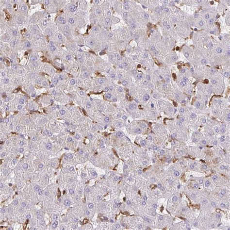 Rabbit Polyclonal Anti Pycard Antibody Buy For Research Highly