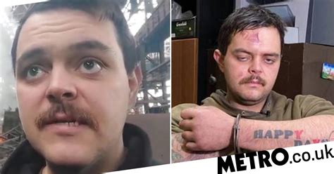 Aiden Aslin Shares Before And After Pictures Showing How He Was Beaten By Russia News Uk