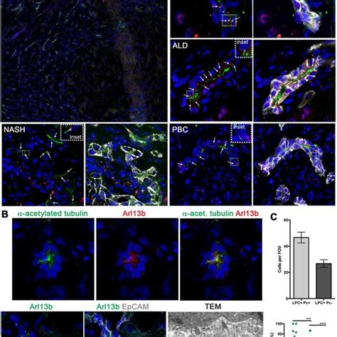 Patient Sample Age Sex Fibrosis Staging Scheuer Score And Shh Download Table