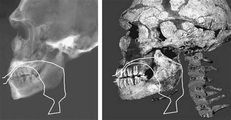 Reconstitution Of The Vocal Tract Shape For I Based On An Assembly