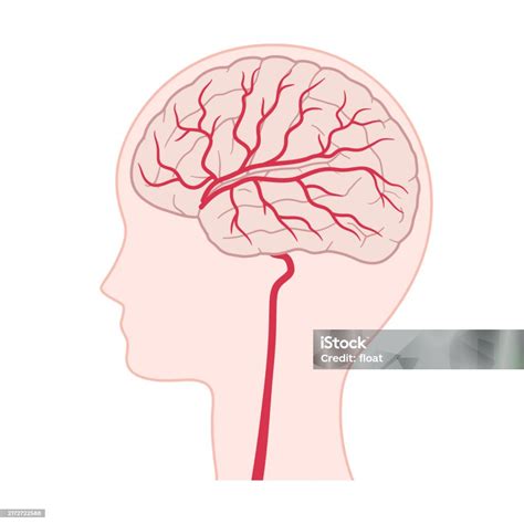 Internal Carotid Artery Stock Illustration Download Image Now Cerebral Artery Ischemic