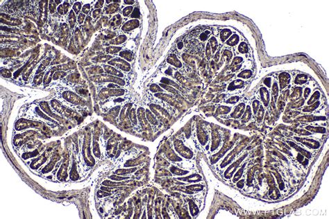 Ihceasy Pim1 Ready To Use Ihc Kit Khc1524 Proteintech