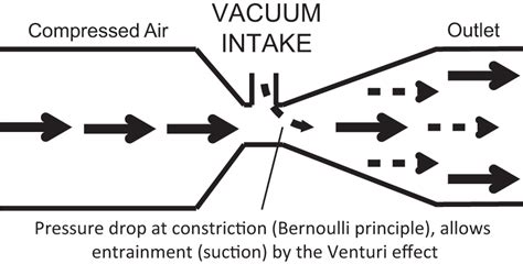 Suction And Vacuum Anesthesia Key