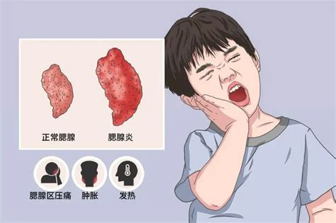 浙江一地紧急提醒，发病数上升，极易传染！绍兴网