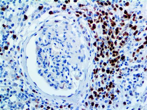 Mum1 Antibody Ep190 Bio Sb