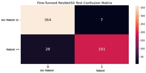 Brain Tumor Detection And Classification Using Fine Tuned Cnn With Resnet50 And U Net Model A