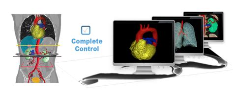 interactive segmentation for oems in radiology via imaging sdks