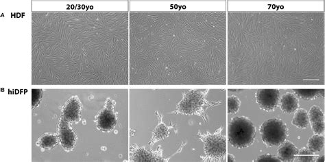 Frontiers Reprogramming Of Adult Human Dermal Fibroblasts To Induced Dorsal Forebrain