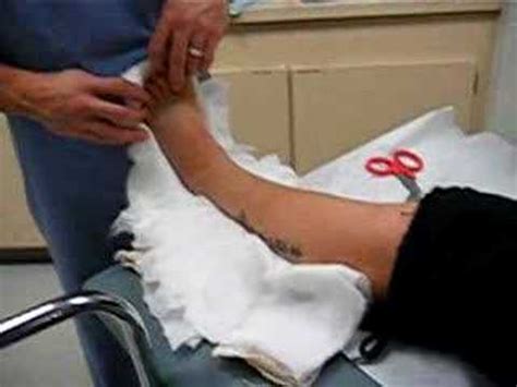 My broken leg - YouTube