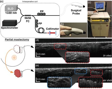 Third Generation Intraoperative Portable Oct System And Handheld Probe