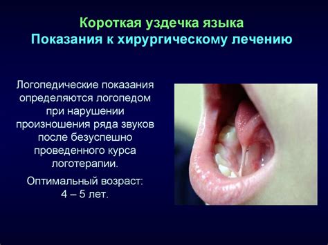 Аномалии развития слизистой оболочки полости рта презентация онлайн