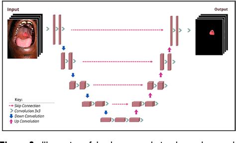 Figure 2 From Deep Convolutional Neural Network Algorithm For The Automatic Segmentation Of Oral