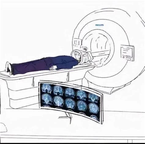 【医学影像】磁共振波谱成像（mrs） 检查 诊断 肿瘤