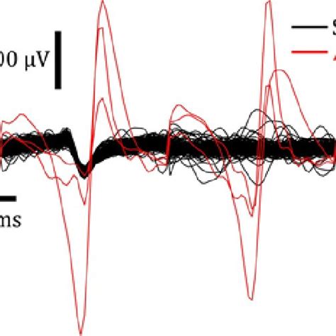 Spike Waveforms Of A Single Cluster Overlaid On Top Of One Another