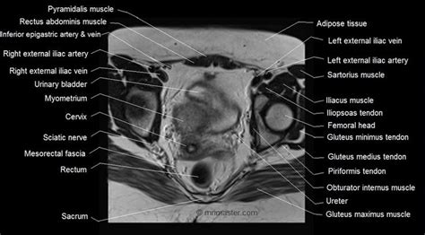 Mri Female Pelvis Anatomy Axial Image 18 Pelvis Anatomy Pelvis Anatomy
