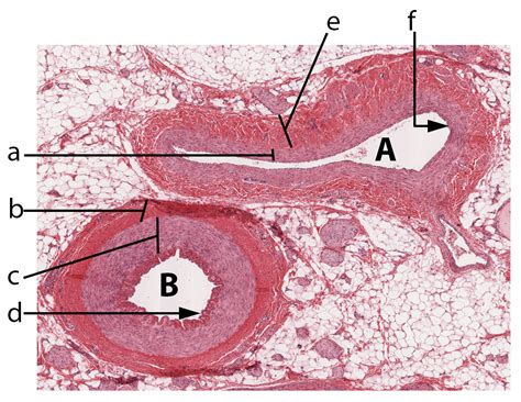 The Histology Of Arteries And Veins Informational Text Images And