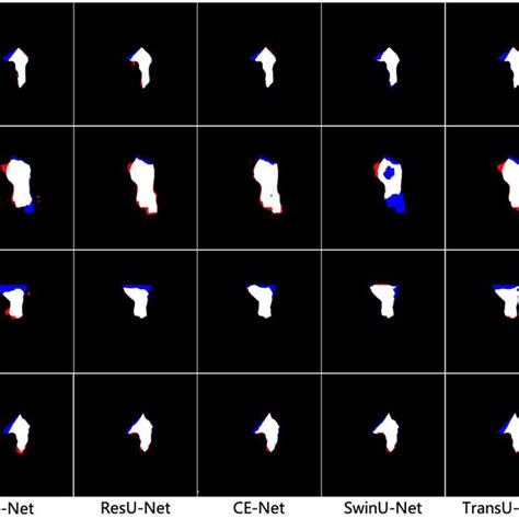 Visualization Results Of Different Methods For Vessel Segmentation On Download Scientific