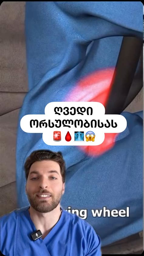 გიორგი ოდიშვილი მცირე ფოტო ვიდეო მასალა პირველადი დახმარების კურსიდან გამომწერებისთვის ⚡️ დიდი