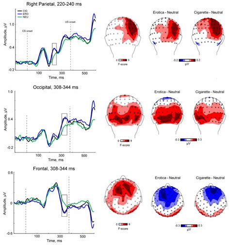 Top Row Left Event Related Potentials To The Geometric Patterns Cs