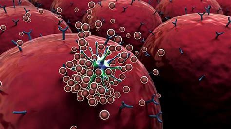 球形红细胞增多症是绝症吗 养生保健 博禾医生