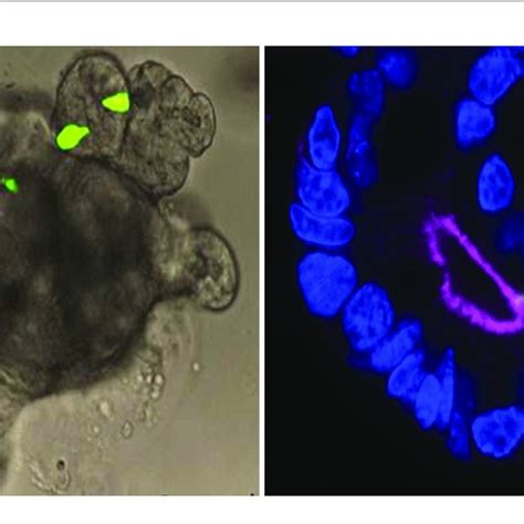 PDF What Is An L Cell And How Do We Study The Secretory Mechanisms Of The L Cell
