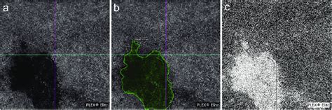 The Figure Shows Techniques Of Manual And Automated Calculation Of