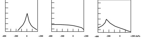 Basic Types Of The Tympanogram Adapted From Bluestone And Klein 1995 Download Scientific Diagram