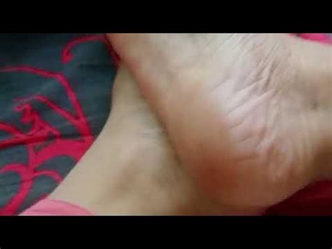 Wrinkled Soles Youtube